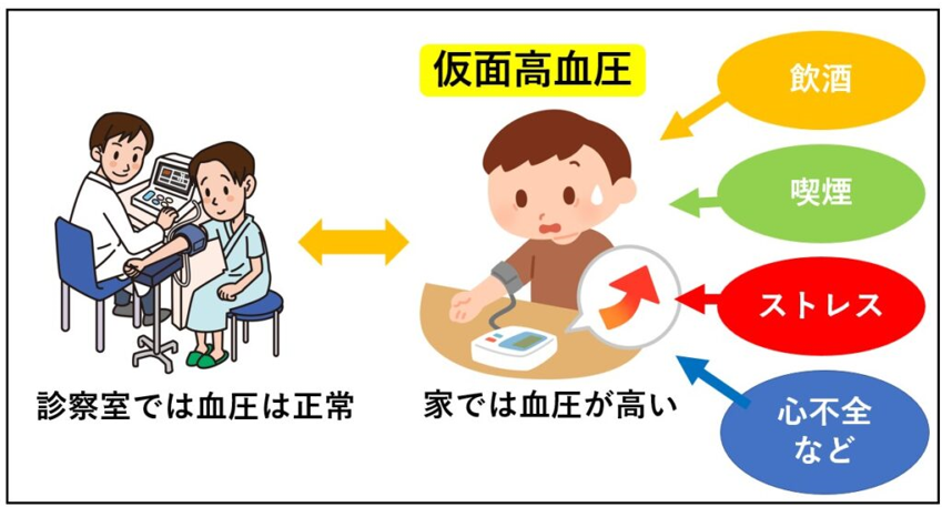 血圧はどの値からが高血圧?|湘南いいだハートクリニック|平塚市の内科(一般内科・循環器・心臓血管)